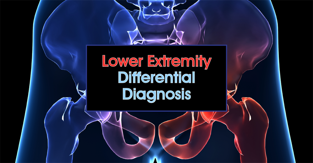Lower Extremity Differential Diagnosis: Maximize evaluation efficiency ...